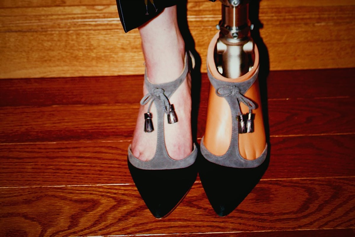 "One Leg, Double the Style" - How This Fashion Blogger's Inspiring ...